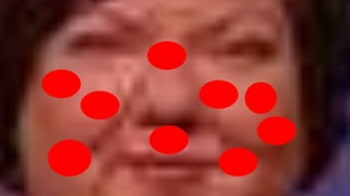 The Popping Pimple Red-Spot Game (Jeopardy! Season 25 Contestant Kitty ...