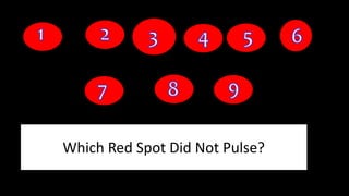 The Popping Pimple Red-Spot Game (Jeopardy! Season 25 Contestant Kitty ...