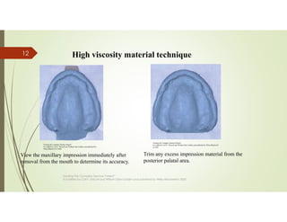 The Post Dam Area: registration and complication | PDF