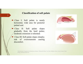 The Post Dam Area: registration and complication | PDF