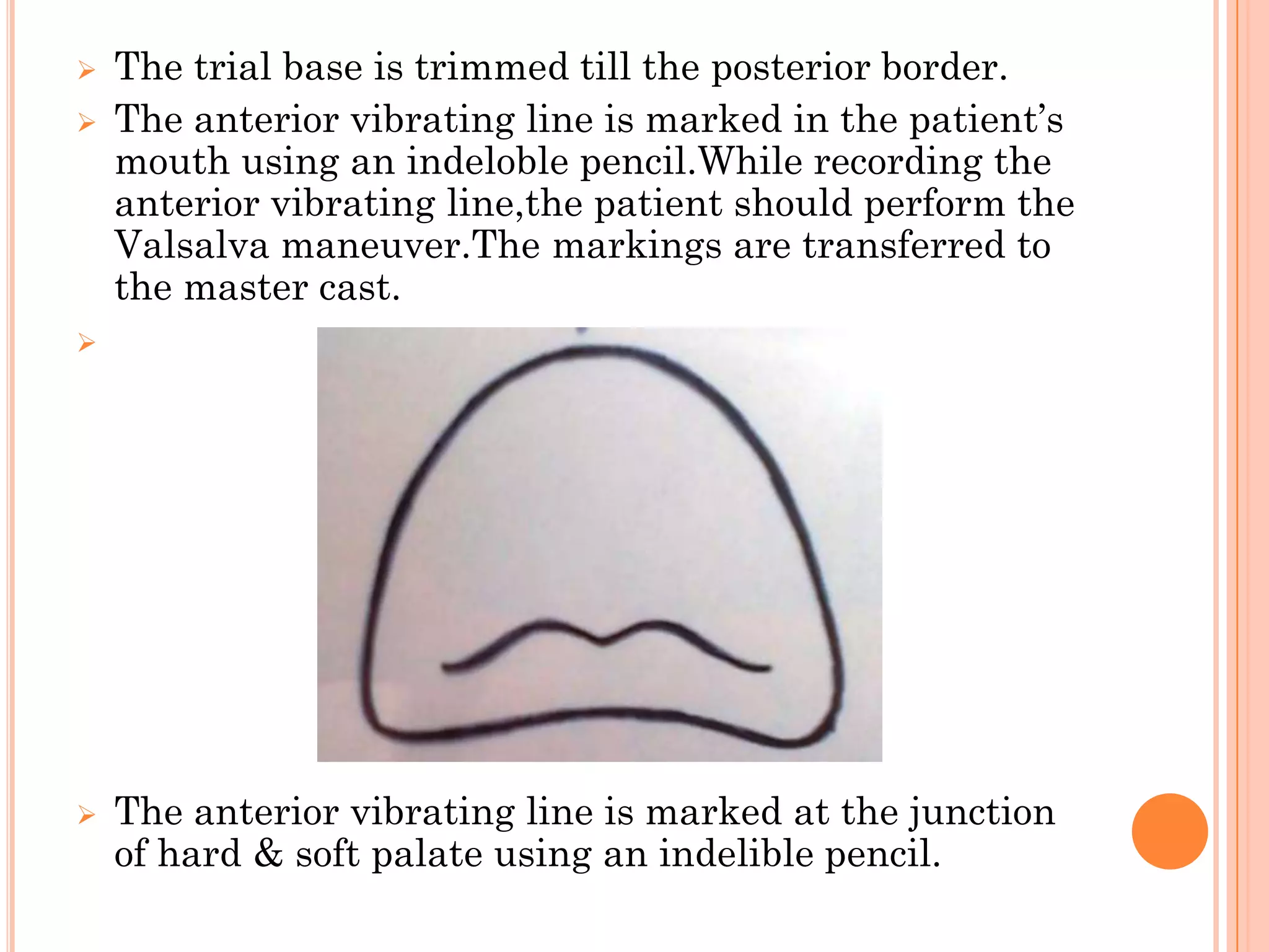 The posterior palatal seal | PPTX