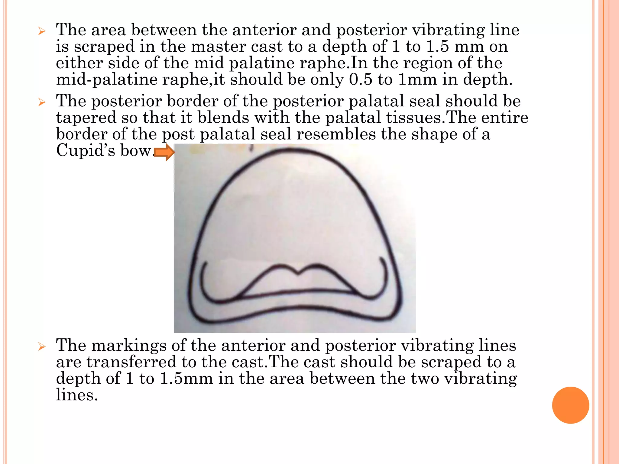 The posterior palatal seal | PPTX
