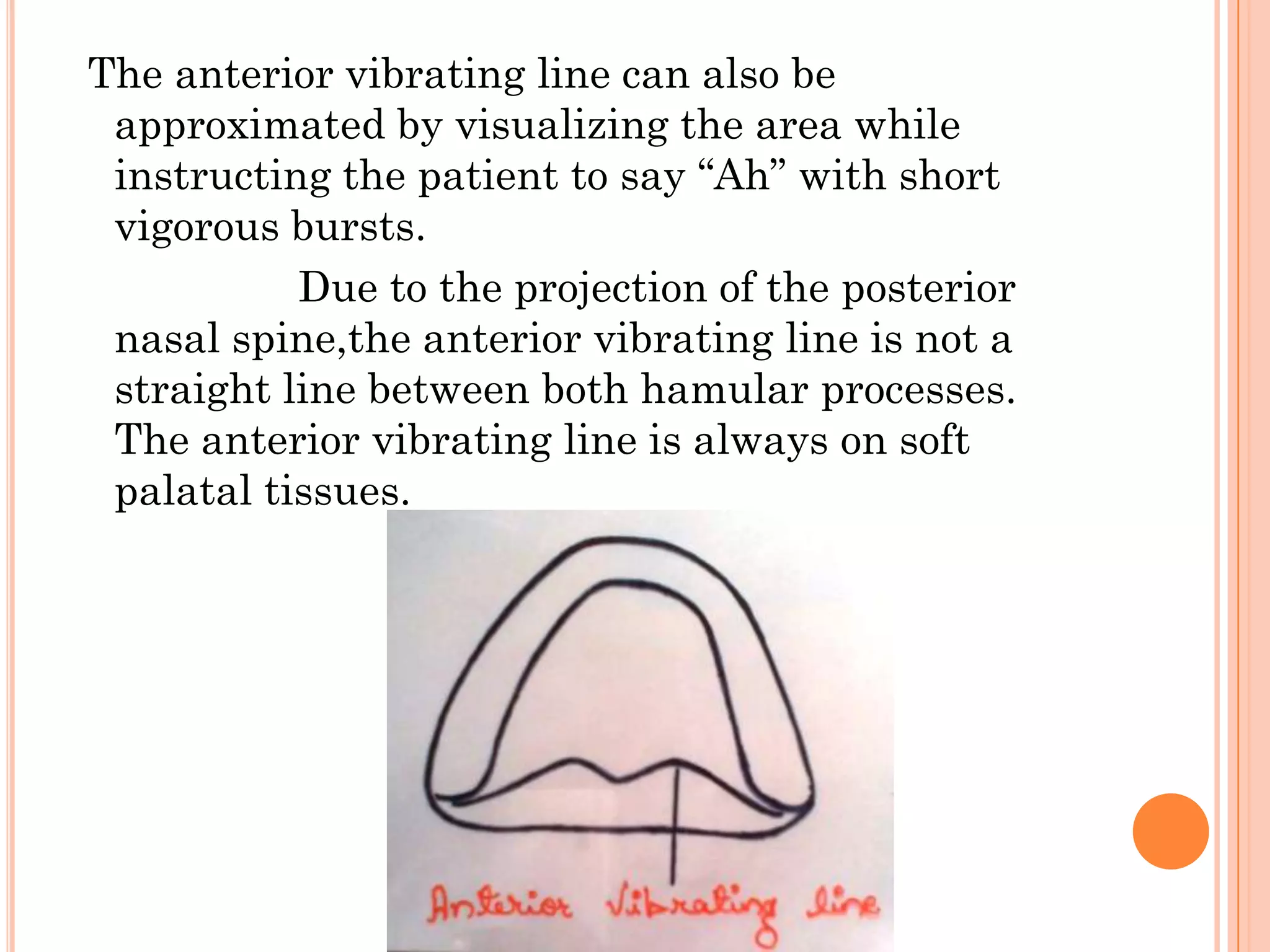 The posterior palatal seal | PPTX