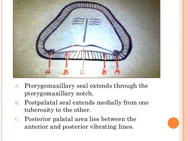 The posterior palatal seal
