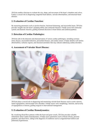 The Potential of 2 Dimensional Echo (Echocardiography) in ...