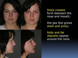 The power of face lift | PDF