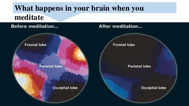 The power of meditation and how it affects our brains