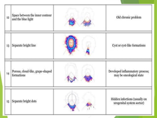 OM: Bio-Well Tutorial 1 - The practical science of measuring human ...