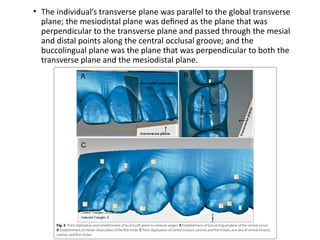 The predictability of orthodontic tooth movements through clear.pptx