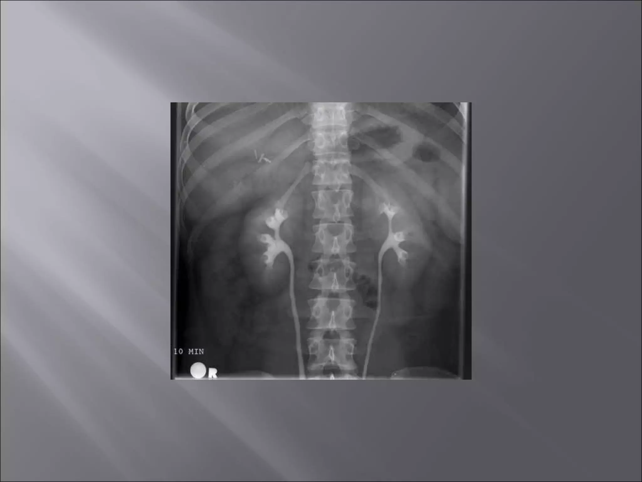 The presentation of radiograph | PPT