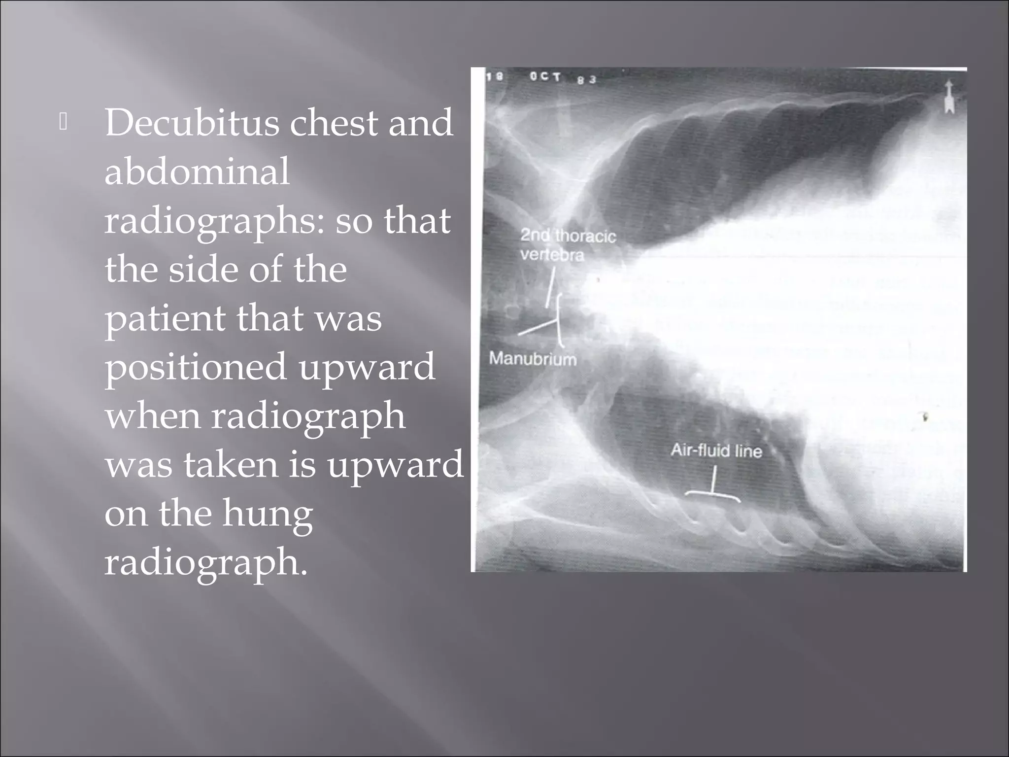 The presentation of radiograph | PPT