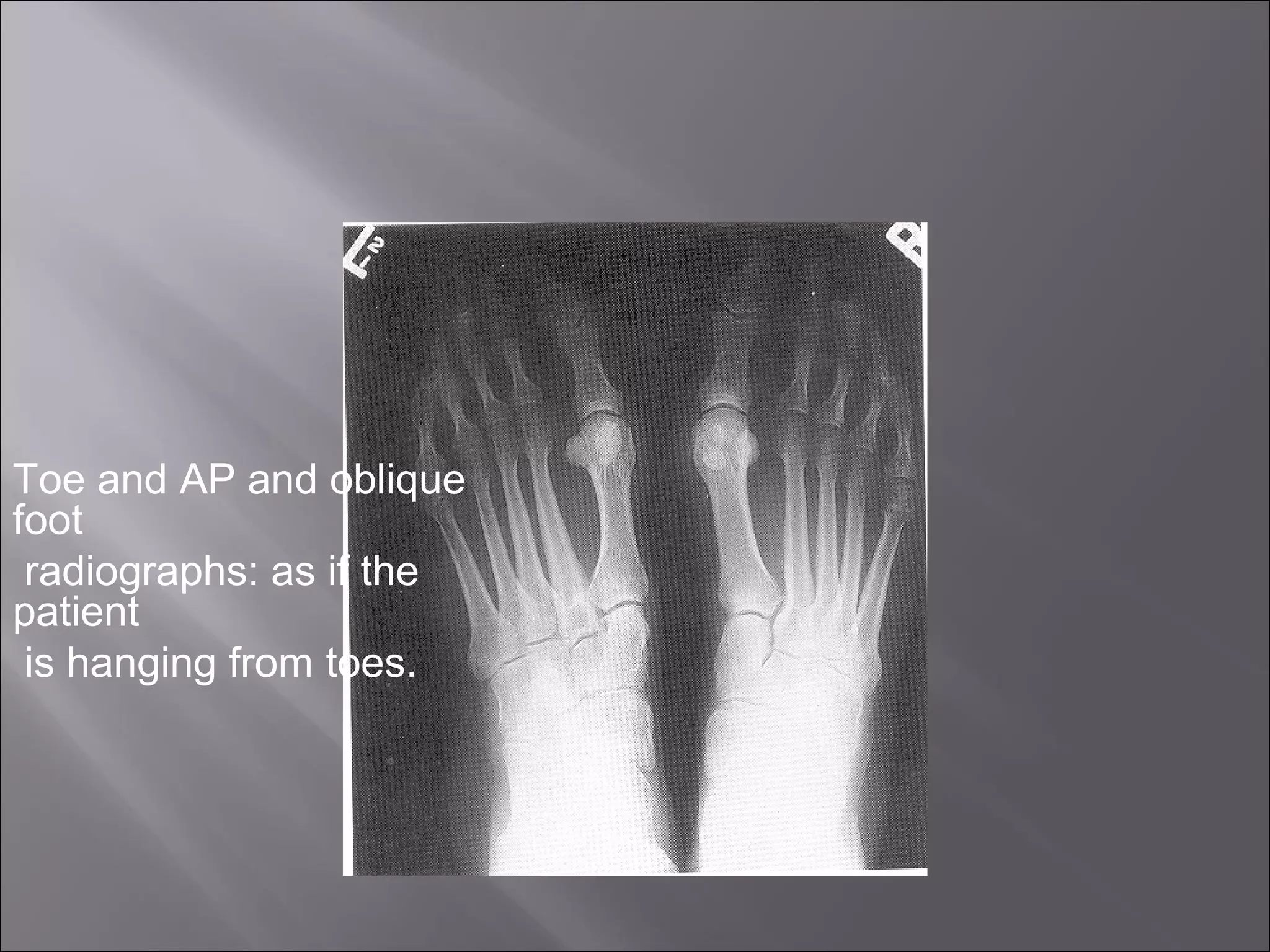 The presentation of radiograph | PPT