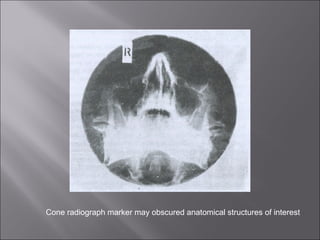 The presentation of radiograph | PPT