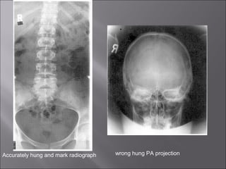 The presentation of radiograph | PPT