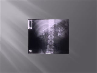 The presentation of radiograph | PPT