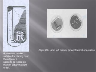 The presentation of radiograph | PPT