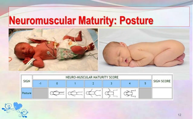 The preterm infant | PPTX