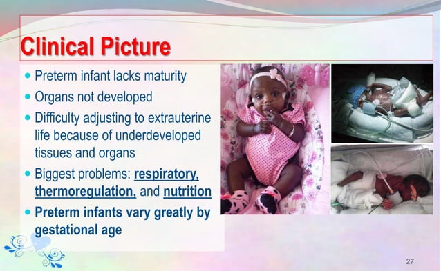The preterm infant | PPTX