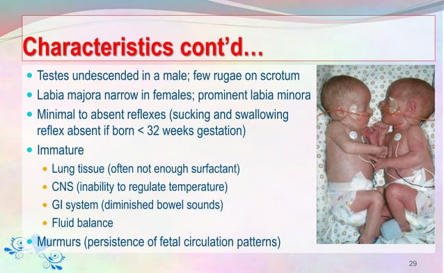 The preterm infant | PPTX