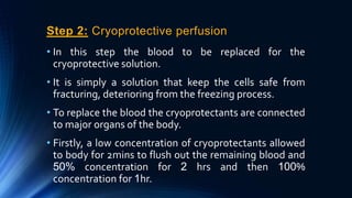 Cryo-Preservation of Humans | PPT