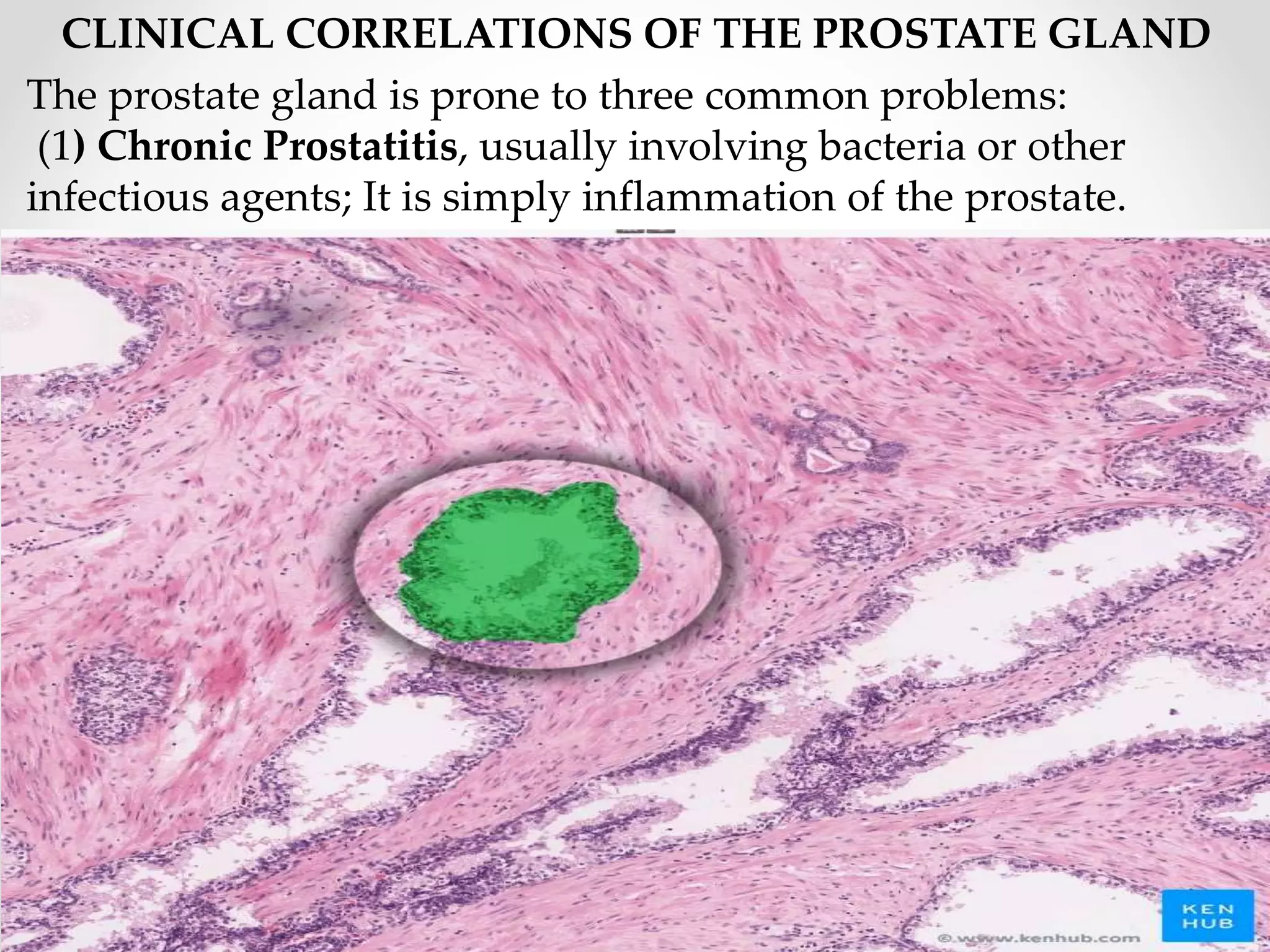 The Prostate Gland.pptx
