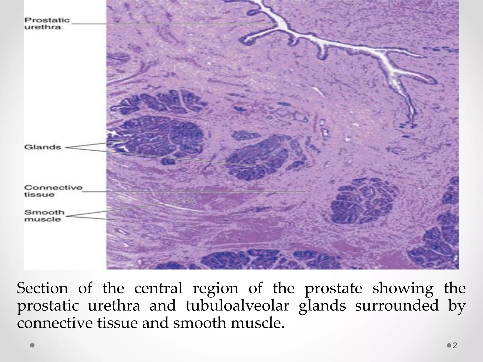 The Prostate Gland.pptx