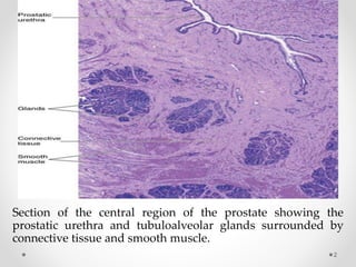 The Prostate Gland.pptx