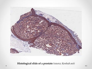 The Prostate Gland.pptx