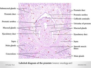 Prostatic Concretions Histology
