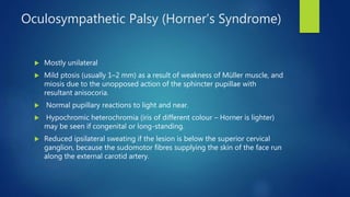 The pupil and it’s abnormalities | PPTX