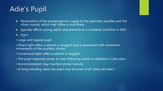 The pupil and it’s abnormalities | PPTX