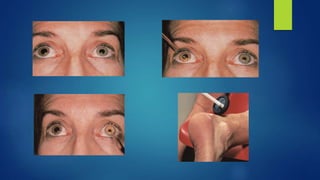 The pupil and it’s abnormalities | PPTX