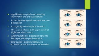 The pupil and it’s abnormalities | PPTX | Eye and Vision Conditions ...