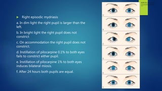 The pupil and it’s abnormalities | PPTX