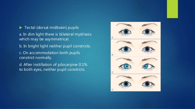 The pupil and it’s abnormalities