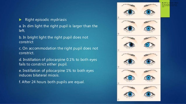 The pupil and it’s abnormalities