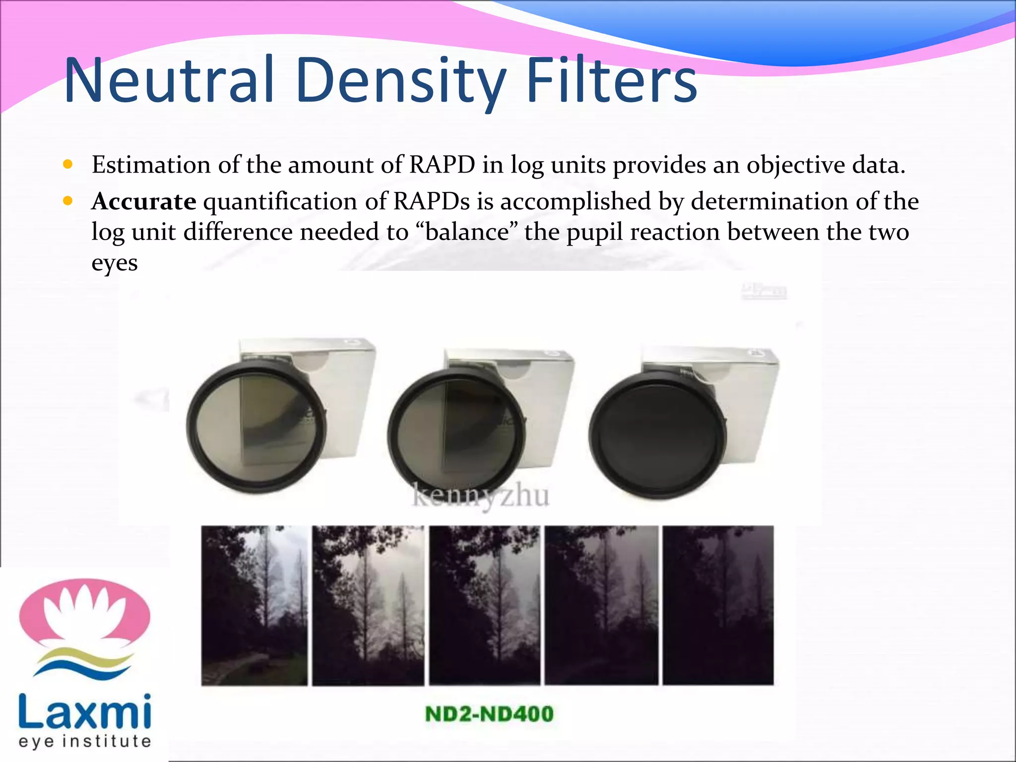 The pupillary pathway and its clinical aspects | PPTX