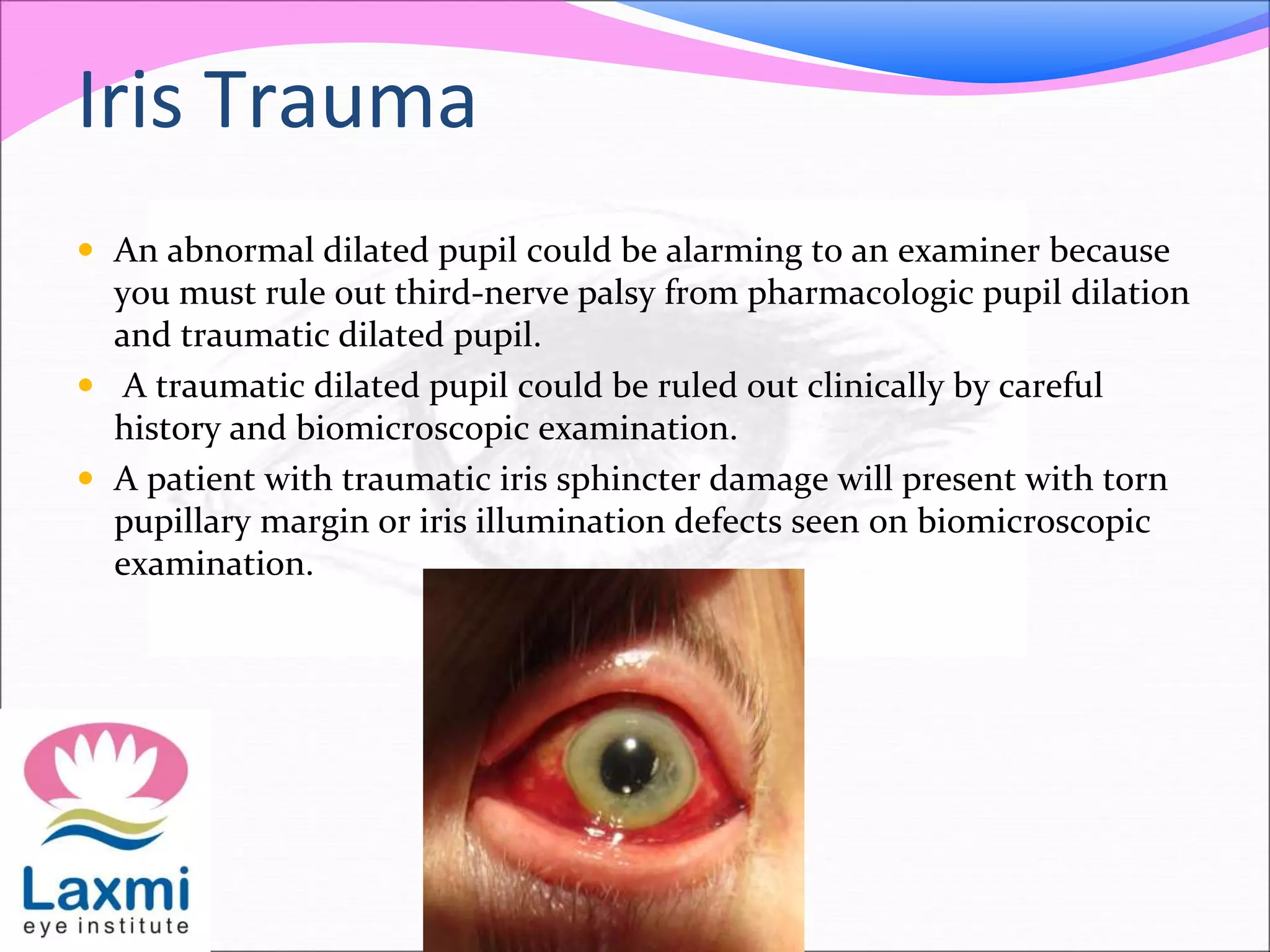 The pupillary pathway and its clinical aspects | PPTX