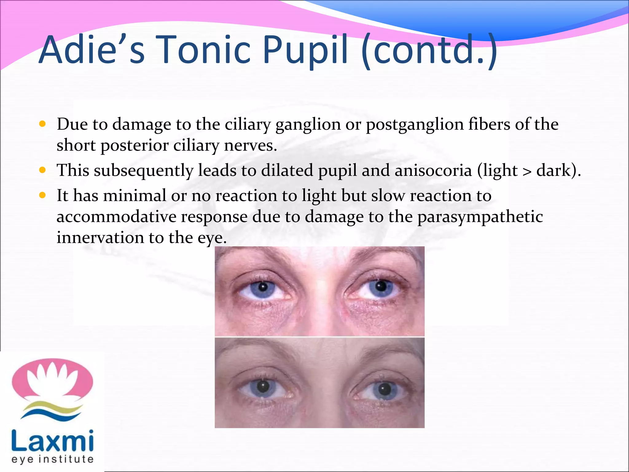 The pupillary pathway and its clinical aspects | PPTX