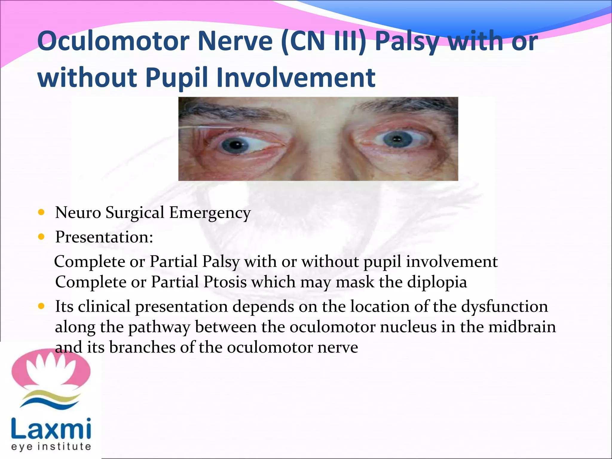 The pupillary pathway and its clinical aspects | PPTX