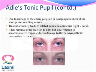 The pupillary pathway and its clinical aspects | PPTX