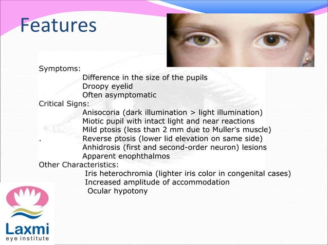 The pupillary pathway and its clinical aspects | PPTX