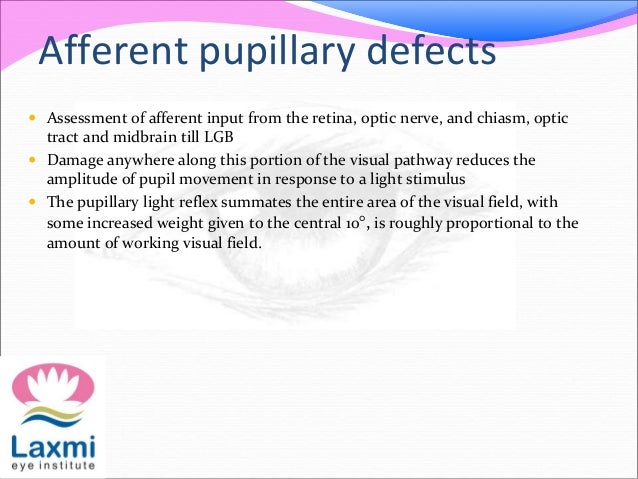 Afferent Pupillary Defect