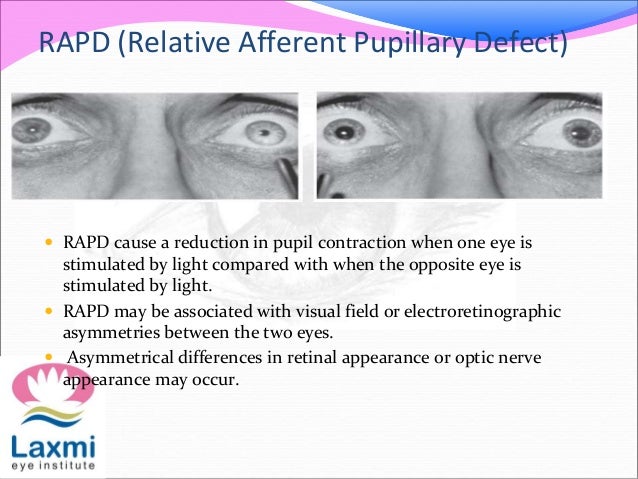 The pupillary pathway and its clinical aspects