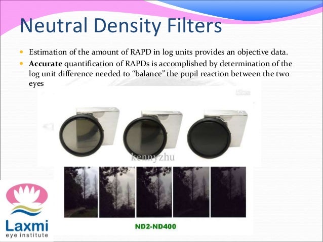 The pupillary pathway and its clinical aspects