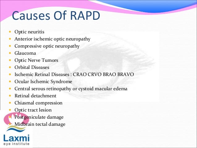 The pupillary pathway and its clinical aspects