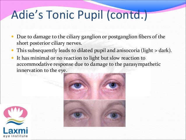 The pupillary pathway and its clinical aspects