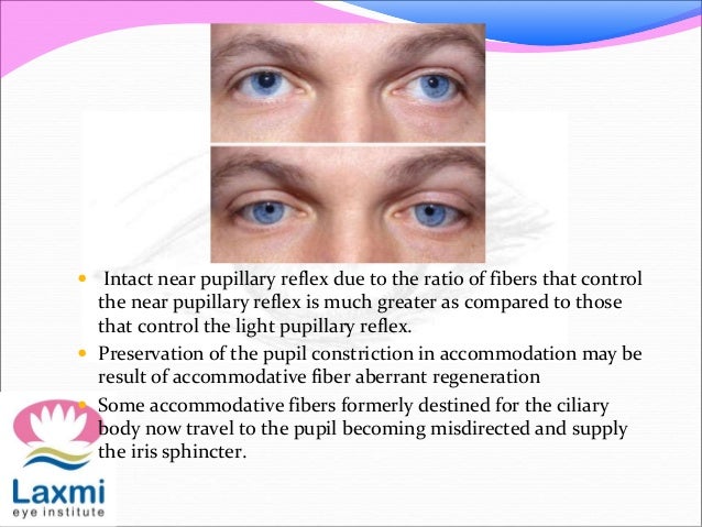 The pupillary pathway and its clinical aspects