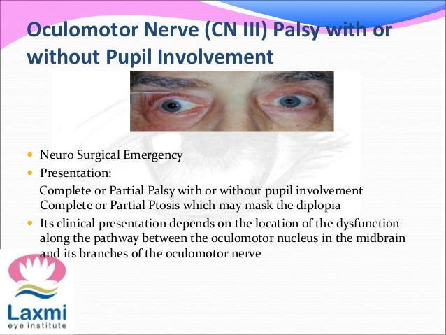 The pupillary pathway and its clinical aspects