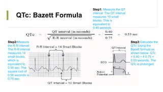 The q t interval | PPTX